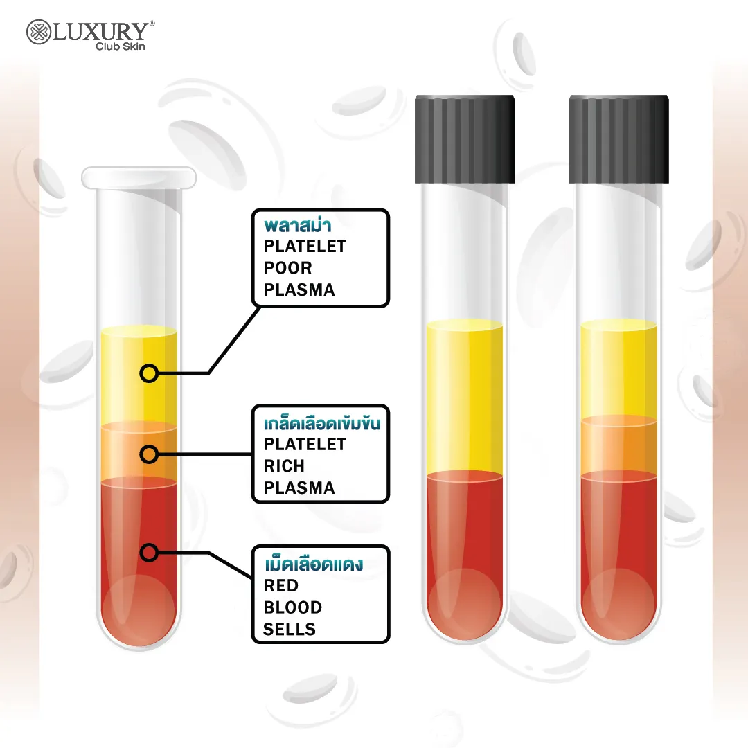 PRP SWIZ’S PLASMA อนุภาคแห่งความเยาว์วัย ฟื้นฟูเซลล์ผิวให้เปล่งปลั่ง ...