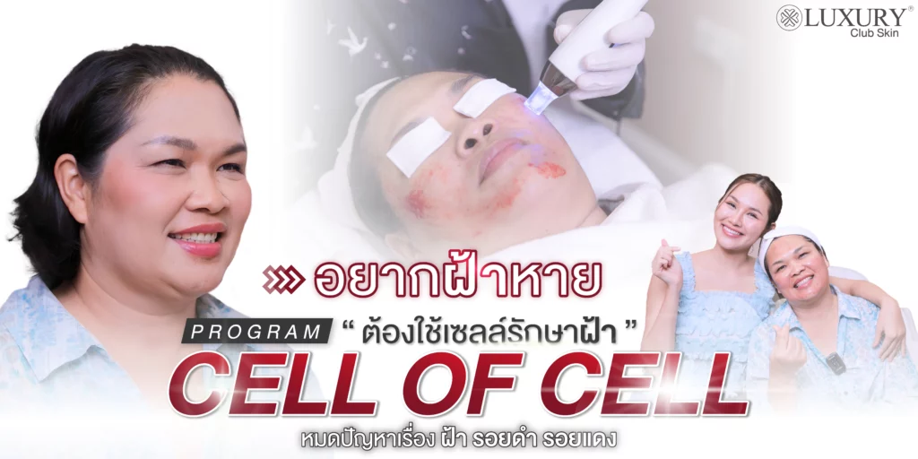 อยากฝ้าหายต้องใช้ Cell of Cell รักษาฝ้า หมดปัญหากวนใจ